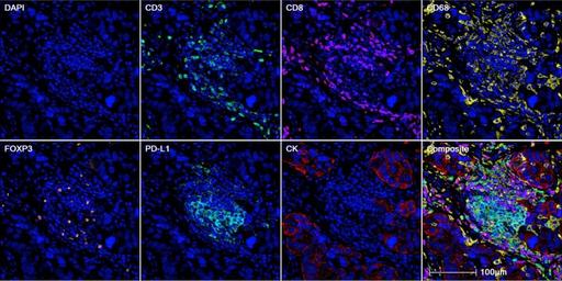 Multiplex IHC Immuno-mapping by JY's Lab @IMCB - A*STAR Scientific ...